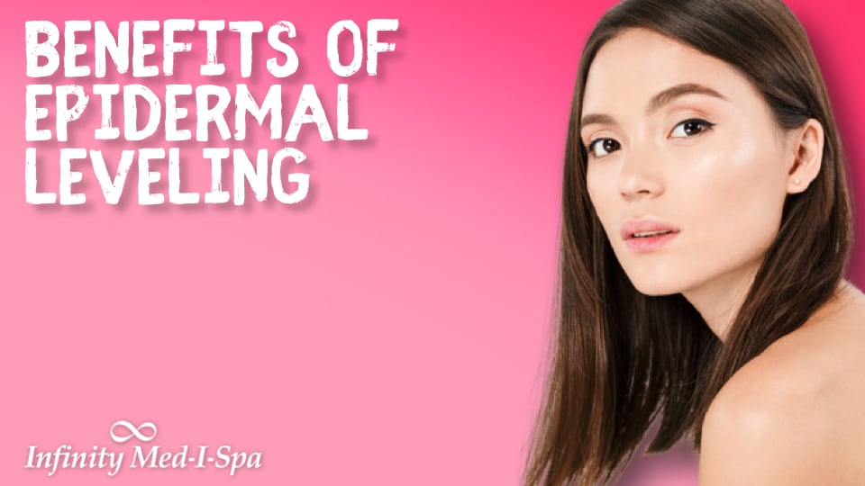What You Need to Know About Epidermal Leveling - Infinity Med-I-Spa