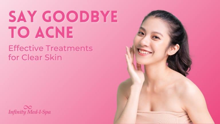 Say Goodbye to Acne: Effective Treatments for Clear Skin - Infinity Med ...