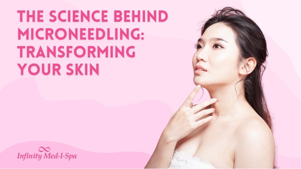 The Science Behind Microneedling: Transforming Your Skin - Infinity Med ...