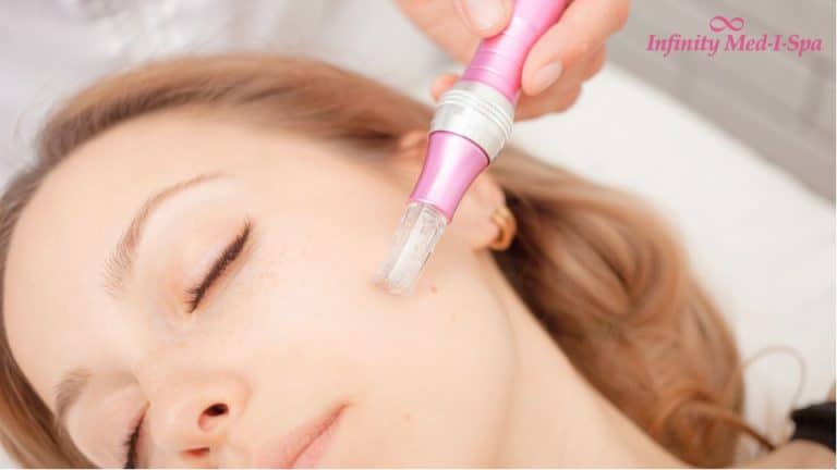 The Science Behind Microneedling: Transforming Your Skin - Infinity Med ...