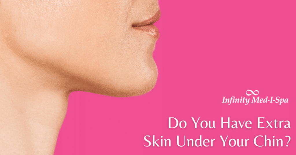 Do You Have Extra Skin Under Your Chin? - Infinity Med-I-Spa