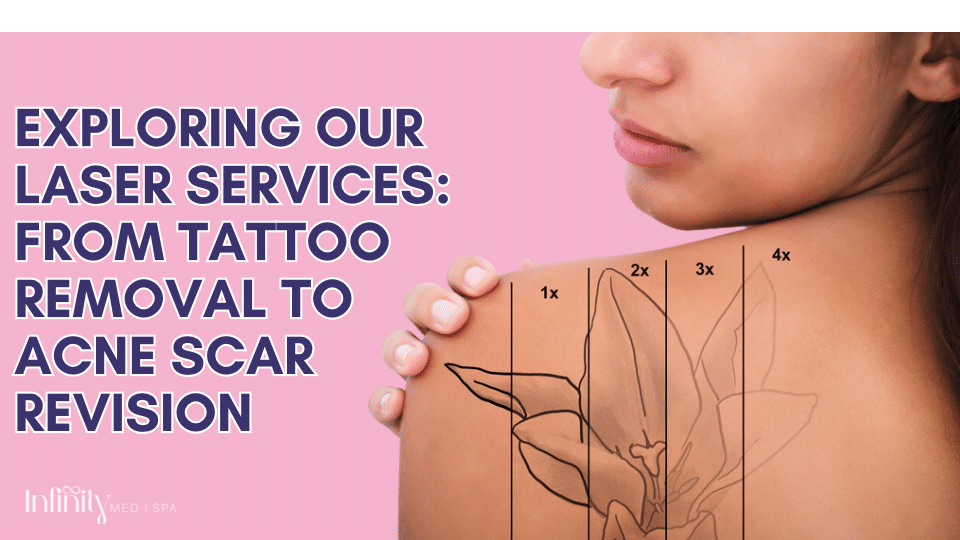 Exploring Our Laser Services: From Tattoo Removal to Acne Scar Revision ...